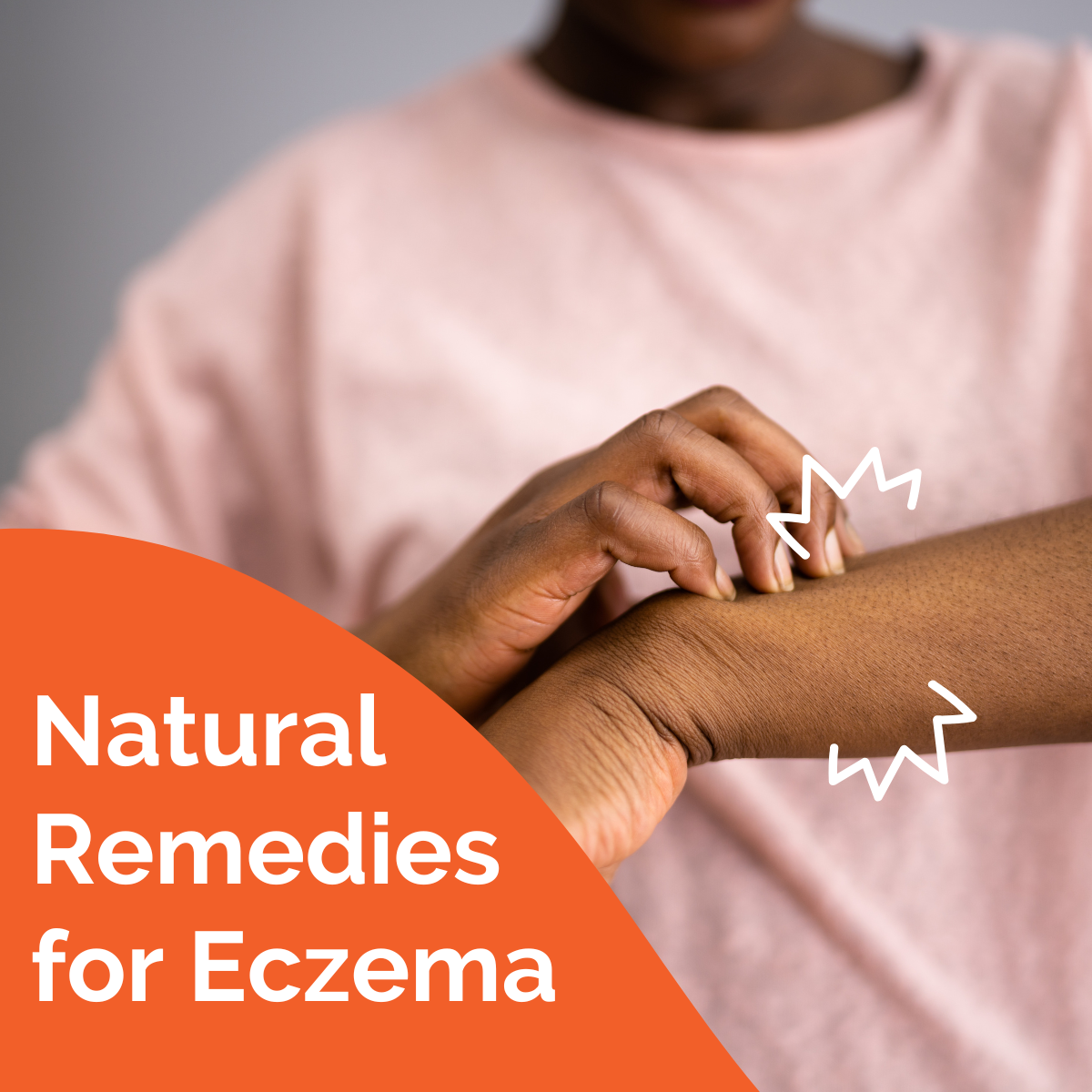 Eczema On Hands Treatment Natural